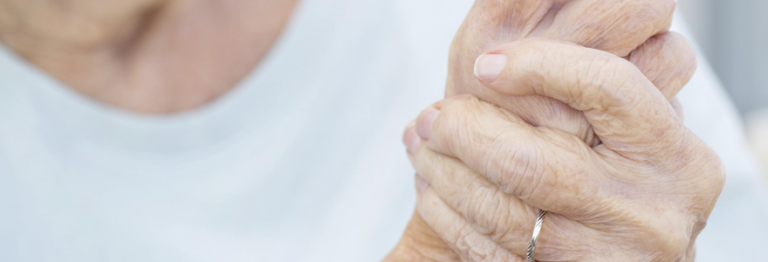 Définition de l’arthrose des doigts ou rhizarthrose